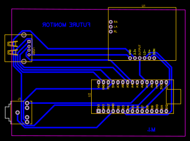 Arduino Patient Monitor - EasyEDA open source hardware lab